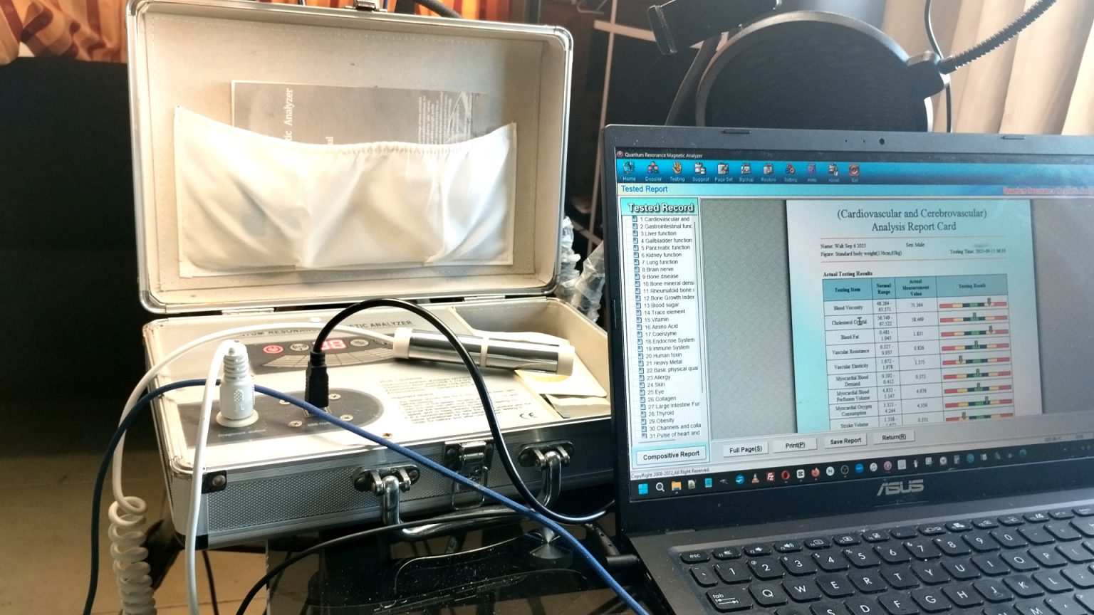 I’ve Found an MRAN Device Online! The Tool That Changed How I Track My Health – The Ageless Adept…